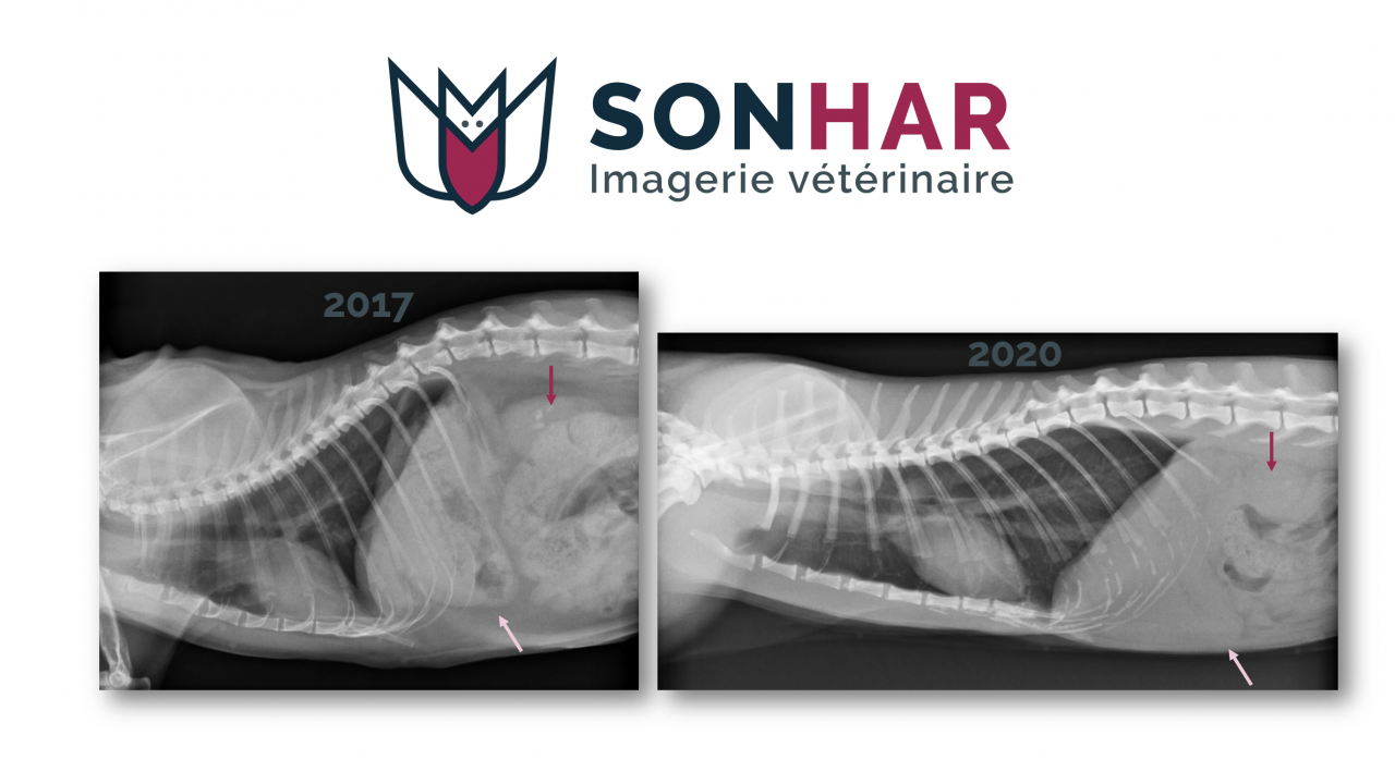Embonpoint et contraste radiographique